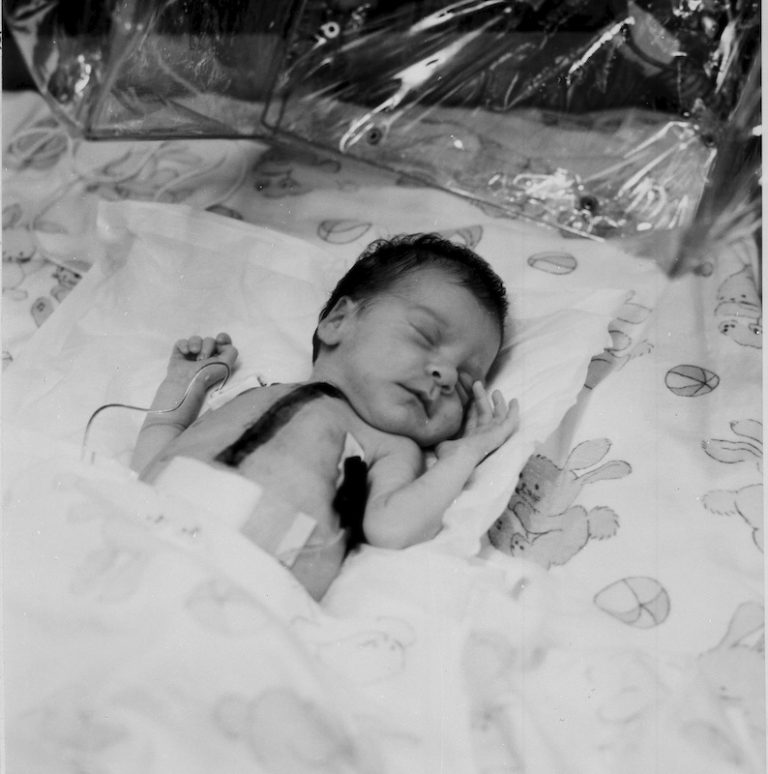 On this day in history: the story of Baby Fae | The Connector